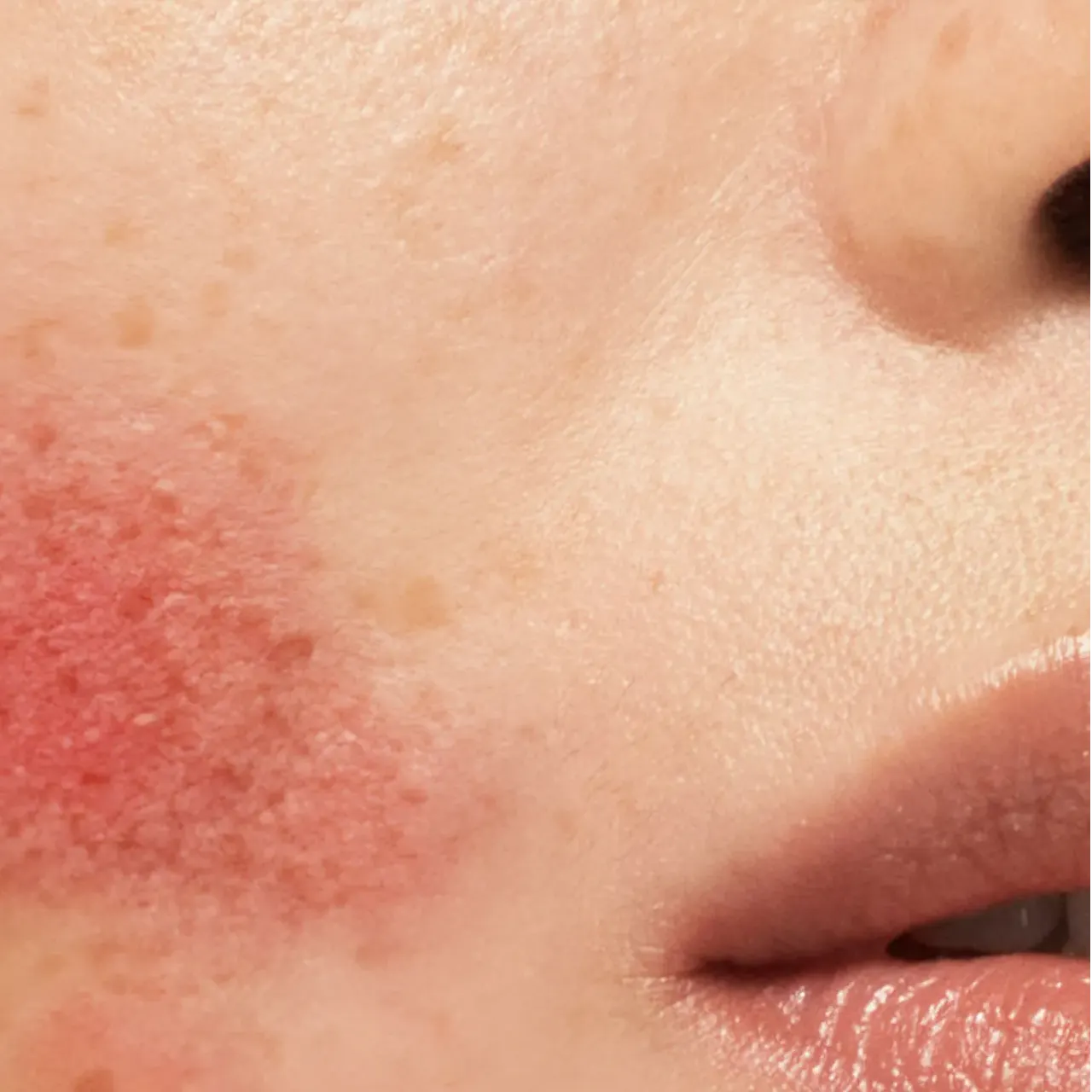 Raudonis ir rožinė – AUM Wellness Clinic